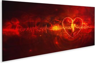 Islandburner Bild auf Leinwand Glühendes Herz mit EKG Linie in Rot für Wohnzimmer Liebespaare Arztpraxis Bilder Wandbilder Poster