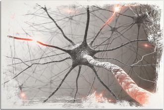 Wallario Wandbild aus Holz Menschliche Nervenzelle - 60 x 90 cm in Premium-Qualit&auml;t: Brillante Farben
