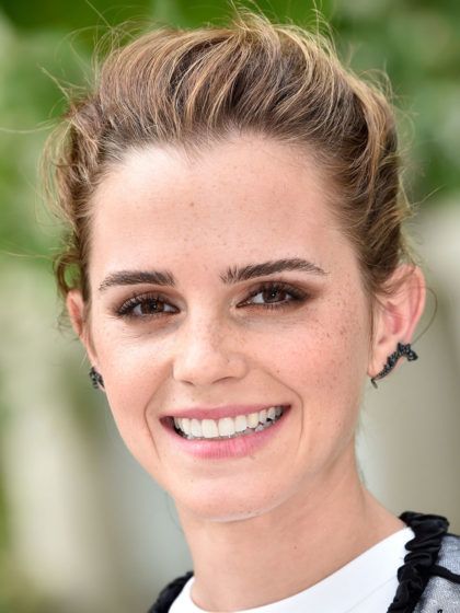 7 wichtige Fragen rund um Sommersprossen, die du schon immer stellen wolltest