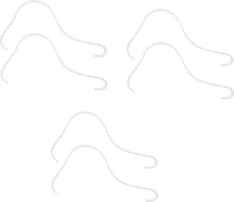 Angoily 6 St&uuml;ck Transparente Acryl Sandalen Display St&auml;nder Elastisch Schuhhalter f&uuml;r Damen Schuhe Organizer Regal Schrank Terrasse Schuhaufbewahrung