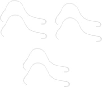 Cabilock 6 Stück Teiliges Transparentes Acryl Schuhdisplay Elastische Damensandalen Halter Leichter Tragbarer Organizer für Schuhpräsentation und Platzsparende